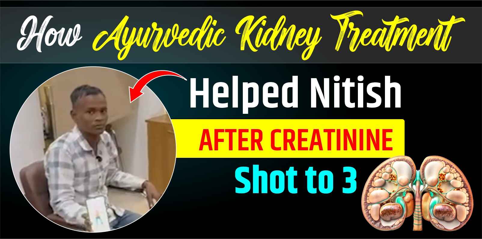 Kidney Stone Ayurvedic Home Remedies: 6 Easy Fixes