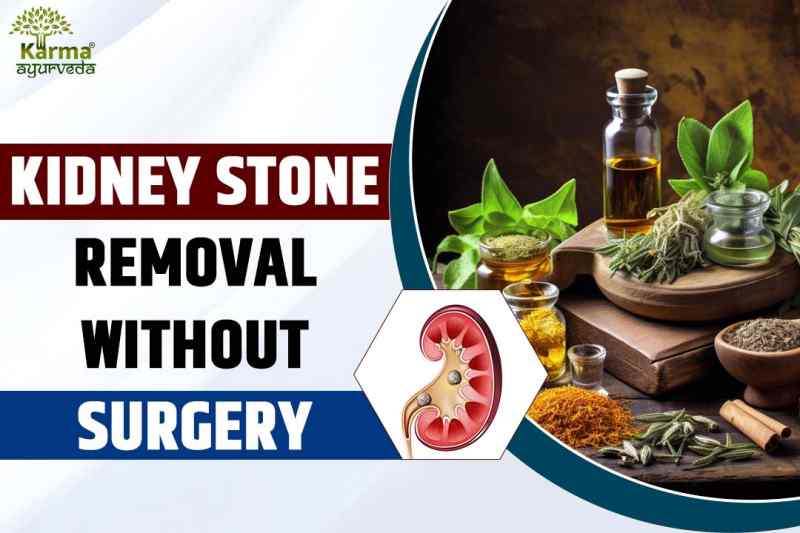 Kidney Stone Removal Without Surgery in Ayurveda