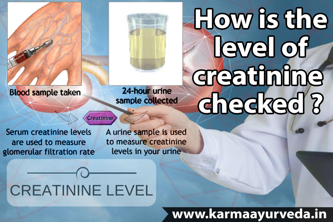 What Level Of Creatinine Indicates Kidney Failure what-level-of-creatinine-indicates-kidney-failure